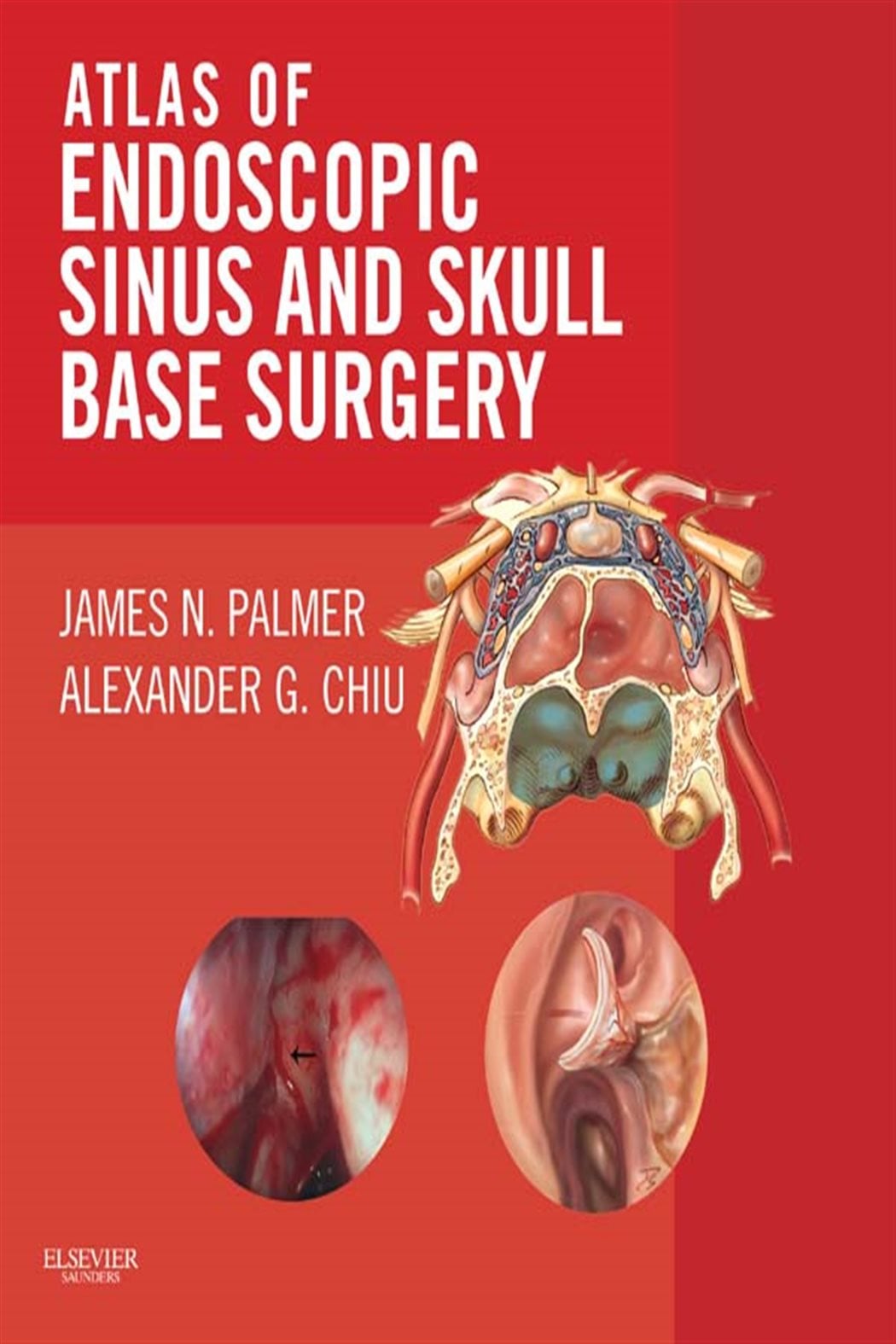 Atlas of Endoscopic Sinus and Skull Base Surgery E-Book