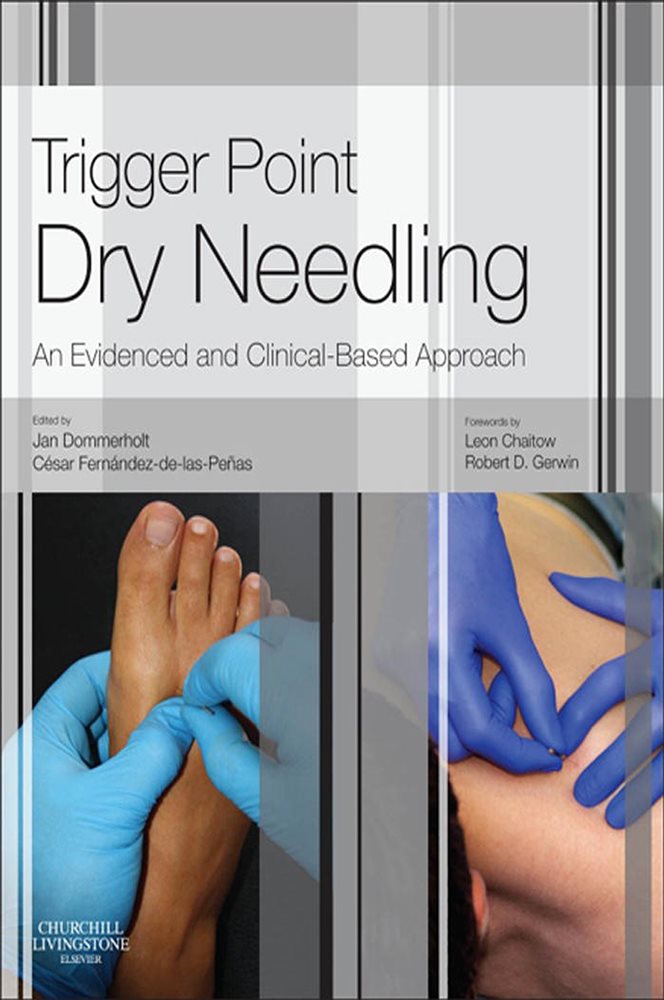 Trigger Point Dry Needling E-Book