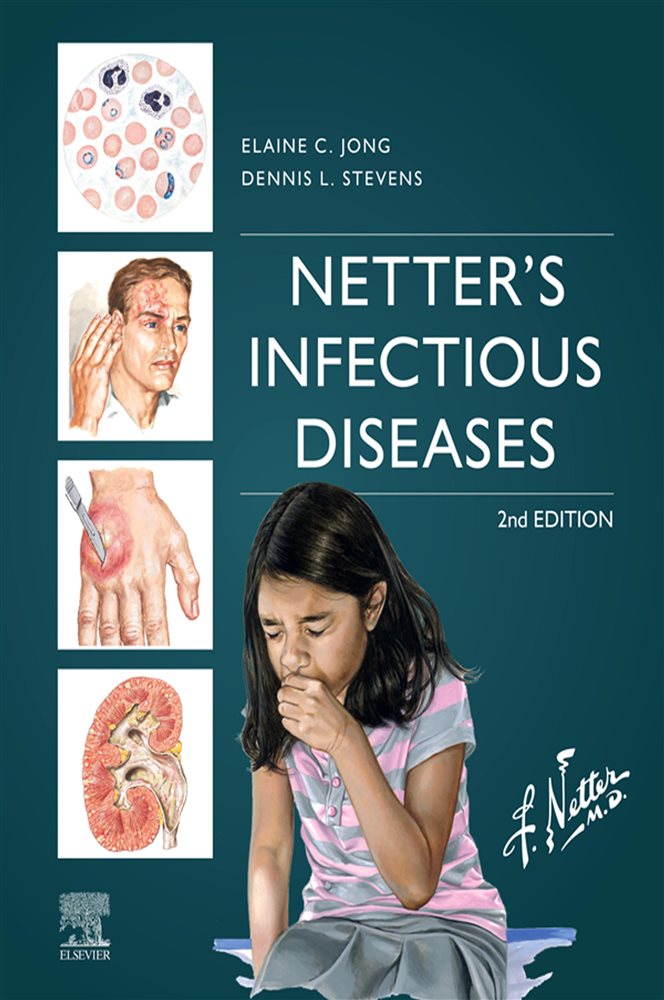 Netter's Infectious Diseases - E-Book (2nd ed.)