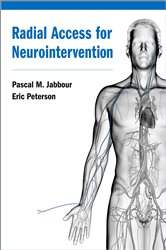 Radial Access for Neurointervention by Pascal Jabbour (ebook)