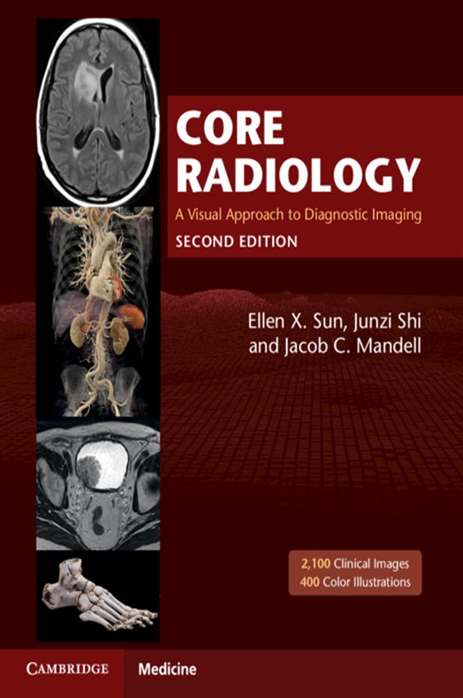 Core Radiology (2nd ed.) by Ellen X. Sun (ebook)