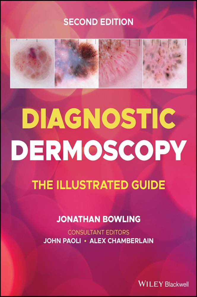 Diagnostic Dermoscopy (2nd ed.) by Jonathan Bowling (ebook)