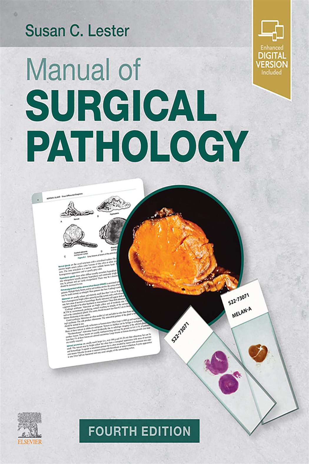 Manual of Surgical Pathology - E-Book (4th ed.)