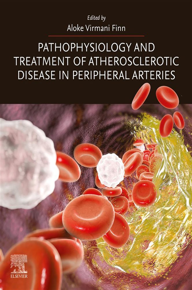 Pathophysiology and Treatment of Atherosclerotic Disease in Peripheral ...