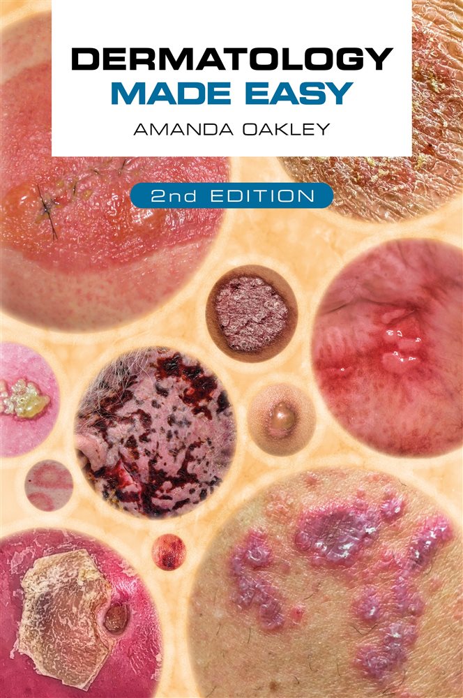 Dermatology Made Easy, second edition (2nd ed.)