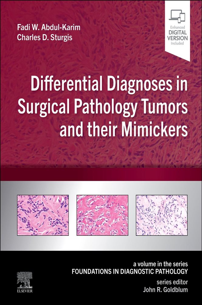 Differential Diagnoses in Surgical Pathology Tumors and their Mimickers ...