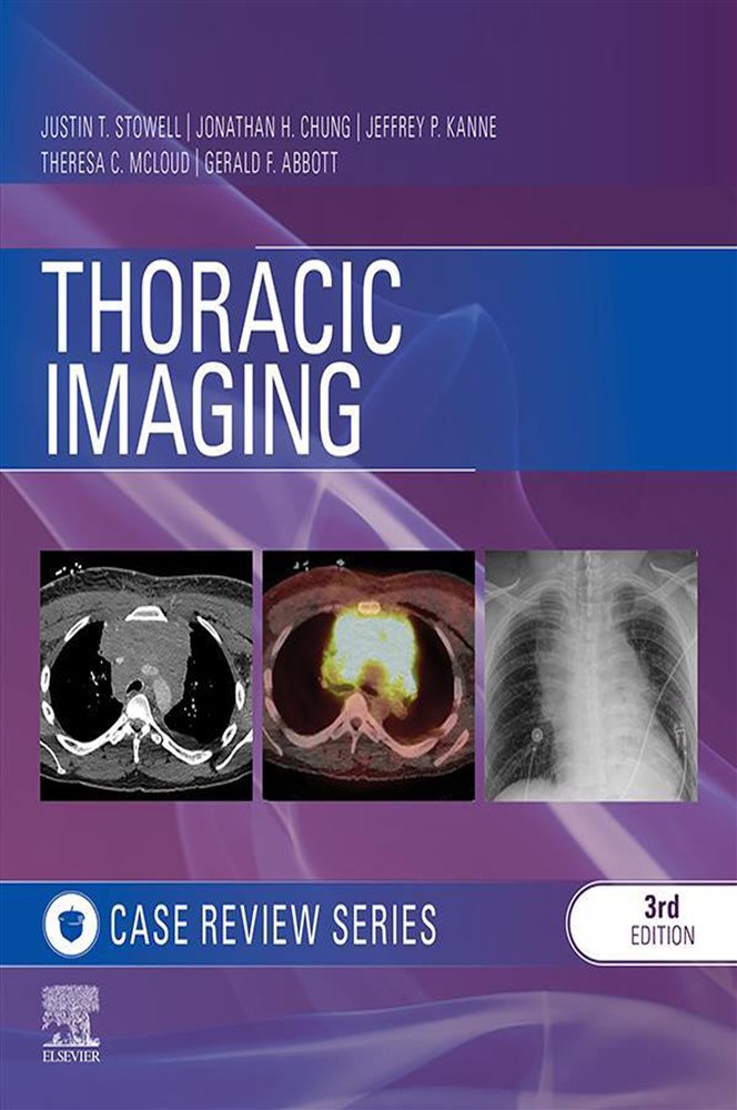 Thoracic Imaging: Case Review Series E-Book (3rd ed.)