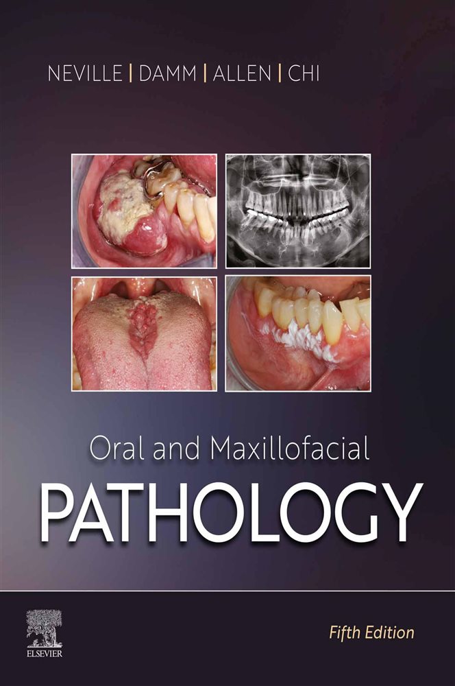 Oral and Maxillofacial Pathology - E-Book (5th ed.)