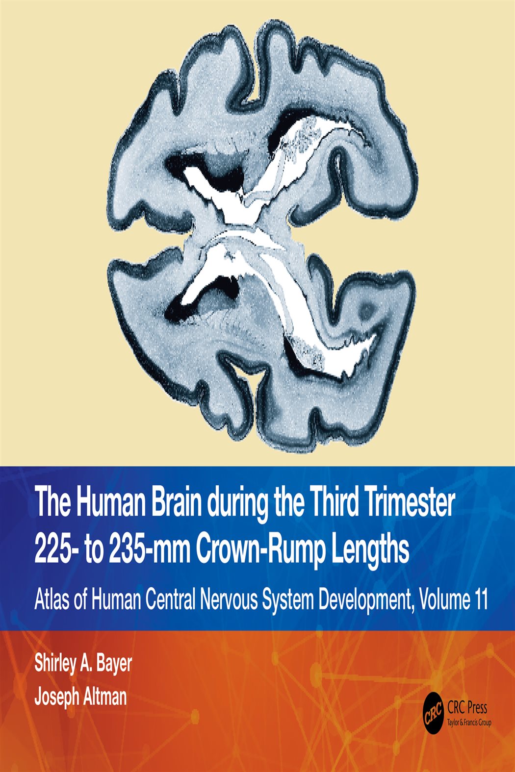 The Human Brain during the Third Trimester 225– to 235–mm Crown-Rump ...