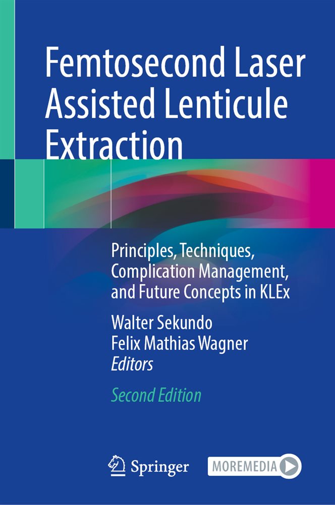 Femtosecond Laser Assisted Lenticule Extraction (2nd ed.)