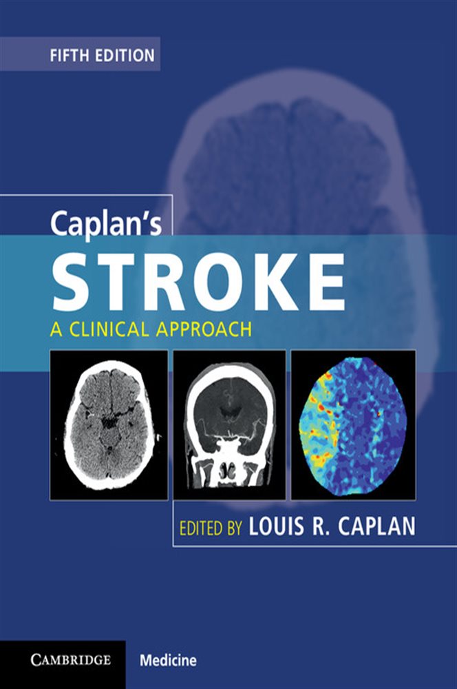Caplan's Stroke (5th ed.) by Louis R. Caplan (ebook)
