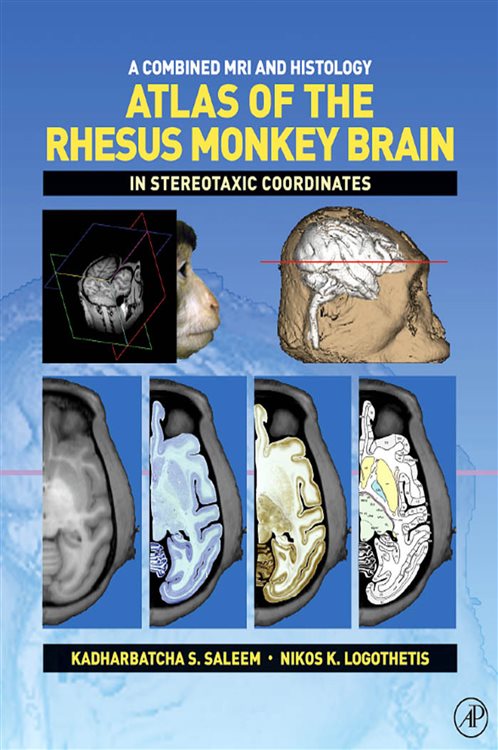 A Combined MRI and Histology Atlas of the Rhesus Monkey Brain in ...