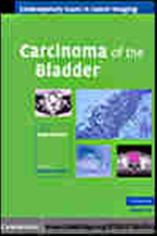 Carcinoma of the Bladder by David MacVicar (ebook)