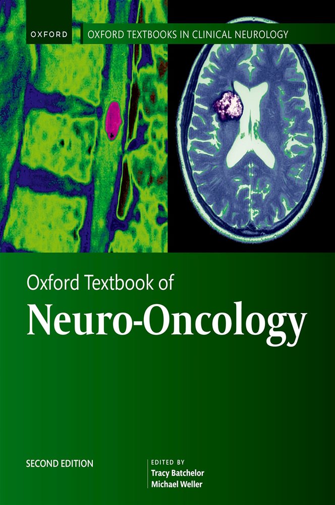 Oxford Textbook of Neuro-Oncology (2nd ed.)
