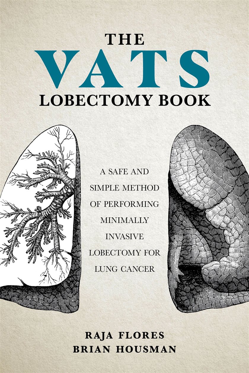 The VATS Lobectomy Book by Housman, Brian F.A.C.S., M.D. (ebook)
