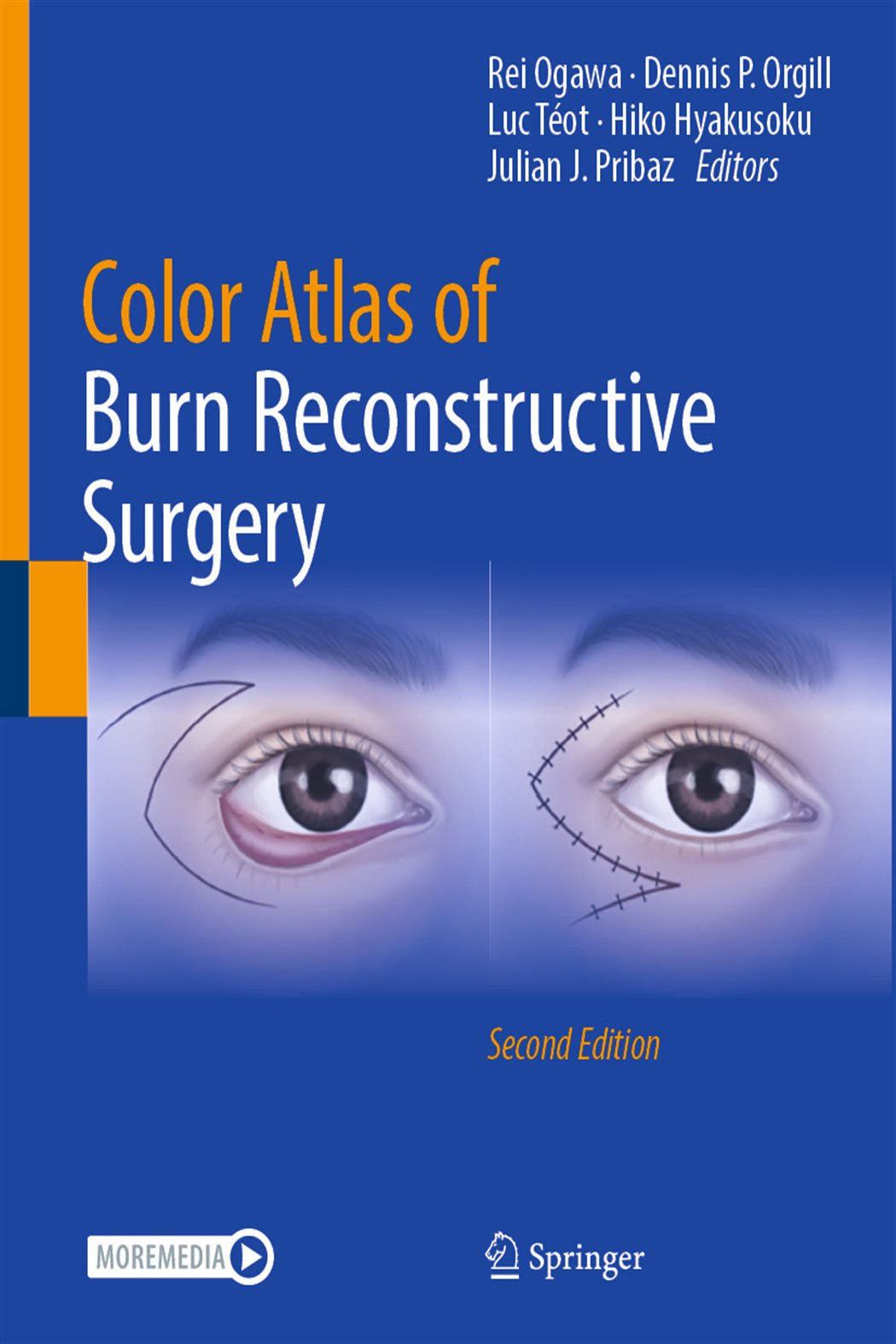 Color Atlas of Burn Reconstructive Surgery (2nd ed.)