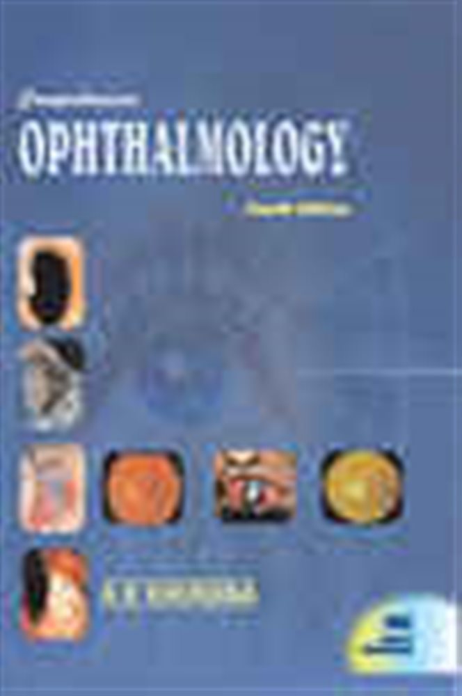 Comprehensive Ophthalmology (4th ed.) by A.K. Khurana (ebook)
