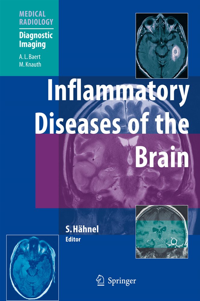 Inflammatory Diseases of the Brain by Stefan Hähnel (ebook)