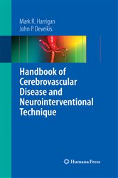 Handbook of Cerebrovascular Disease and Neurointerventional Technique