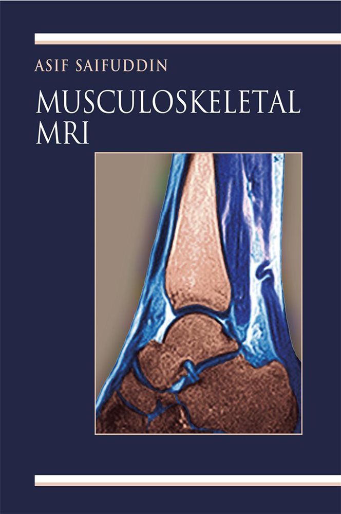 Musculoskeletal MRI by Asif Saifuddin (ebook)