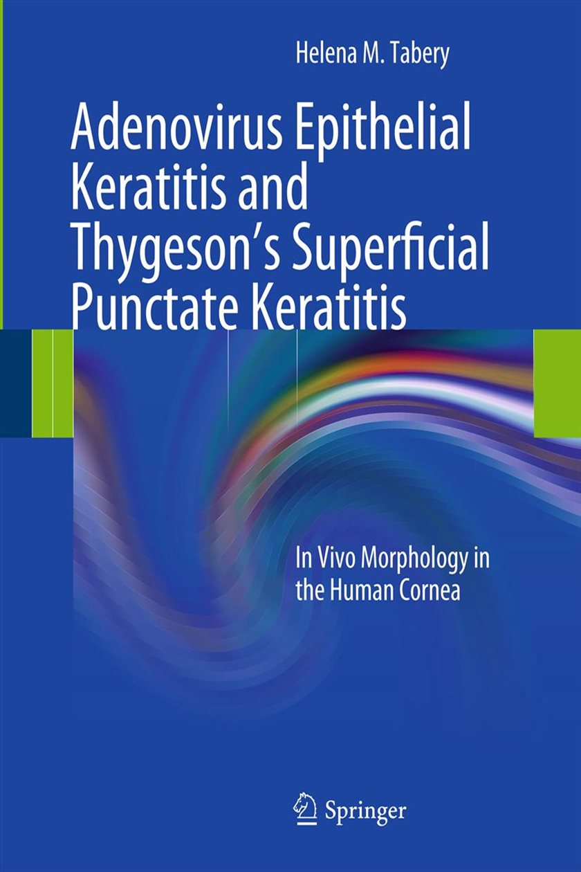 Adenovirus Epithelial Keratitis and Thygeson's Superficial Punctate ...
