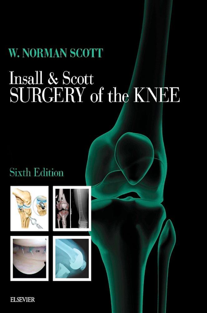 Insall & Scott Surgery of the Knee E-Book (6th ed.)