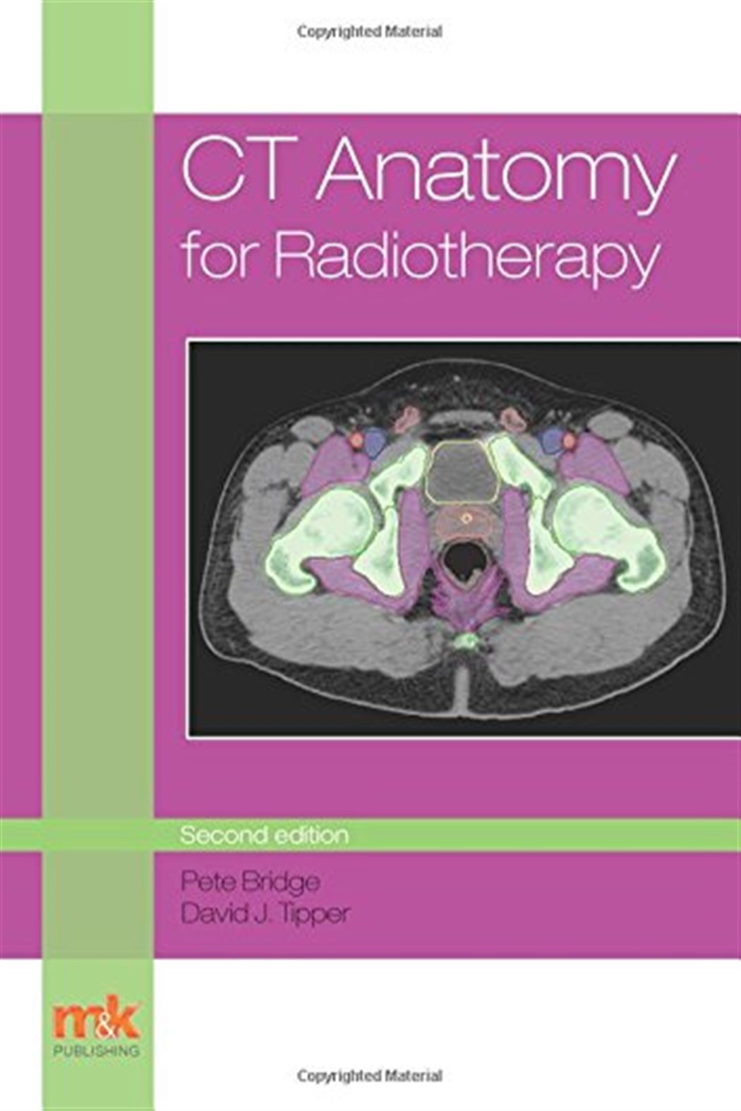 CT Anatomy for Radiotherapy (2nd ed.) by Peter Bridge (ebook)
