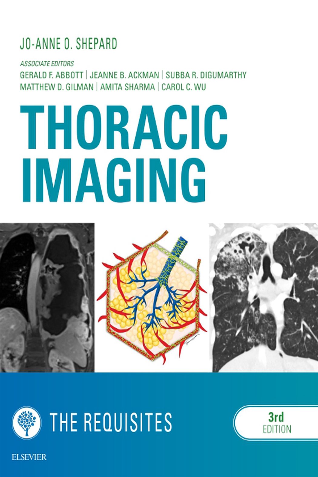 Thoracic Imaging The Requisites E-Book (3rd ed.)