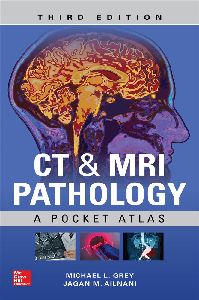 CT & MRI Pathology: A Pocket Atlas, Third Edition (3rd ed.)