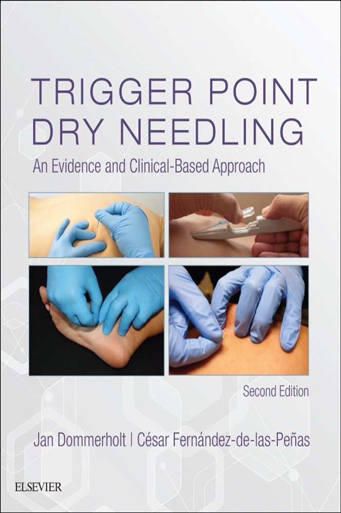 Trigger Point Dry Needling E-Book (2nd ed.)