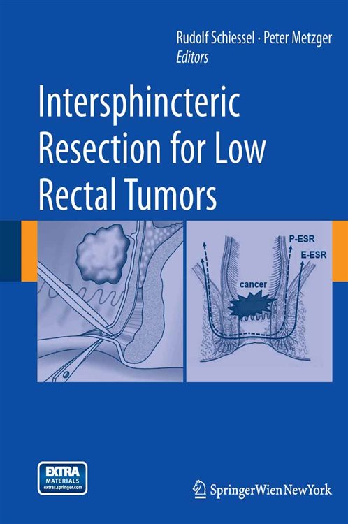 Intersphincteric Resection For Low Rectal Tumors